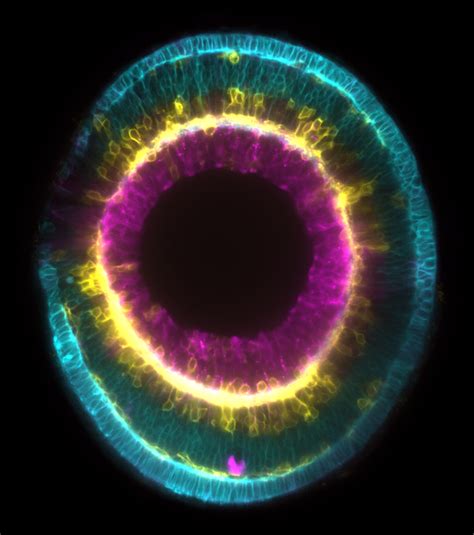 10 Years Of The International Cell Tracking Challenge And