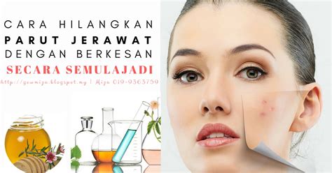 Cara Hilangkan Parut Jerawat Yang Berkesan Secara Natural Amizah Azid