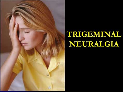Ppt Trigeminal Neuralgia Powerpoint Presentation Free Download Id