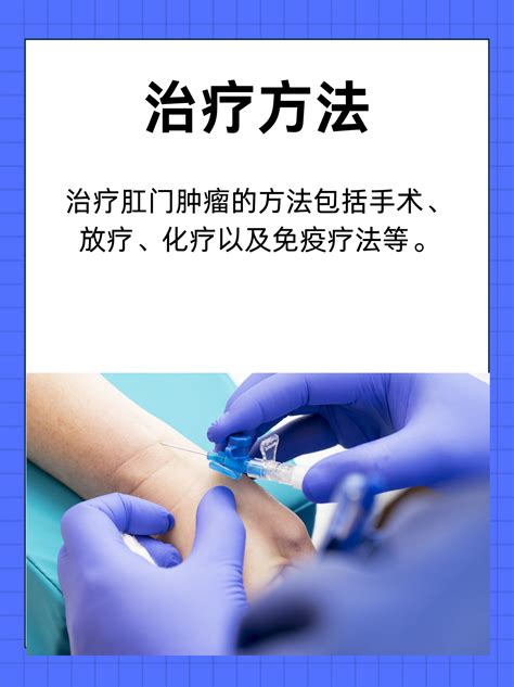 肛门肿瘤能活多长时间