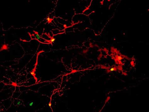 Lab Grown Retinal Cells Open The Door To Treat Blindness And Degenerative Eye Diseases