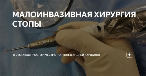 МАЛОИНВАЗИВНАЯ ХИРУРГИЯ СТОПЫ О СУСТАВАХ ПРОСТО И ЧЕСТНО ортопед
