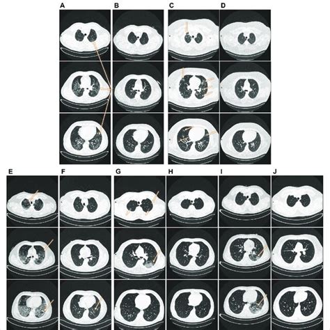 Tandem Mass Spectrometry Ms Ms Representing The Pattern Of Download Scientific Diagram