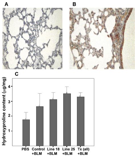 Enhanced Tgfβ1 Immunostaining And Collagen Production In Bleomycin