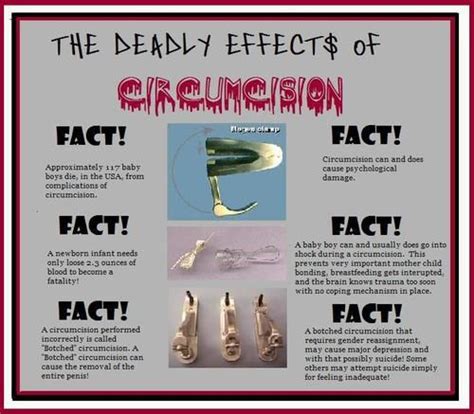 91 Best Circumcision Images On Pinterest Circumcision Pregnancy And Breastfeeding