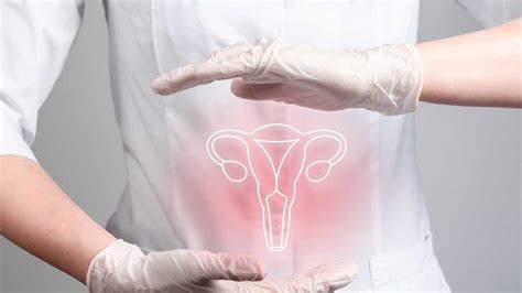 O Que Causa A Endometriose