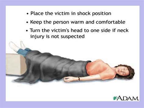 Trendelenburg Position For Shock