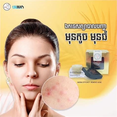 U Me Cambodia Dl អ្នកជំនាញព្យាបាលមុខមុននៅទីនេះ មុនតូច មុនធំ មុនកប់សាច់ មុនក្បាលខ្មៅ មុនអង្កាម