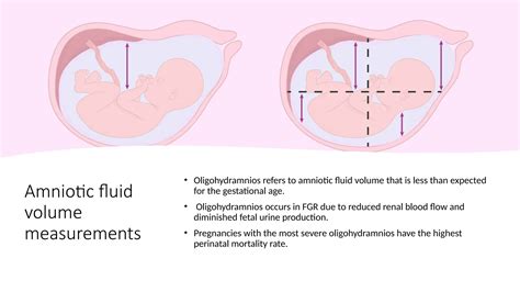 Diagnosis Of Fetal Growth Restrictionpptx