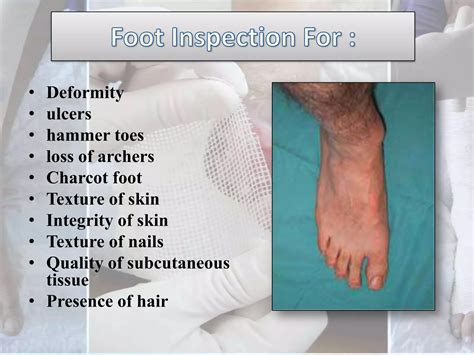 Diabetic Foot Examination Ppt
