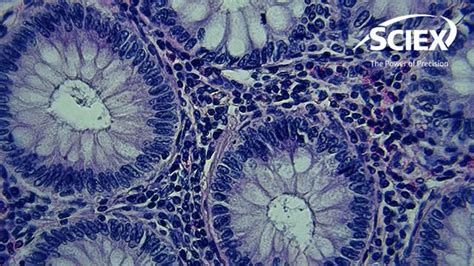 Improving End To End Metabolite Identification By Lc Msms Technology