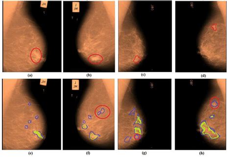 Top Row A D Model Novel Mammograms From The Ddsm Dataset Bottom