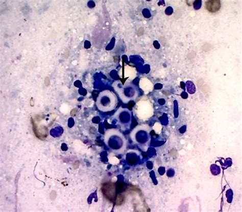 Cryptococcus In Cats