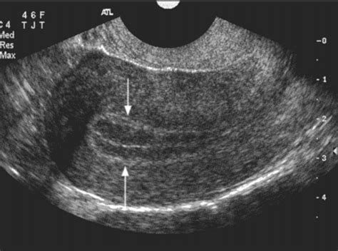 Pelvic Anatomy Quiz Flashcards Quizlet