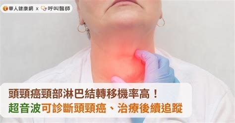 頭頸癌頸部淋巴結轉移機率高！超音波可診斷頭頸癌、治療後續追蹤 華人健康網 專業即時優質的健康新聞及資訊分享平台業即時優質的健康新聞及