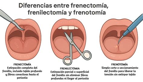 Frenillo Anatomía Masculina