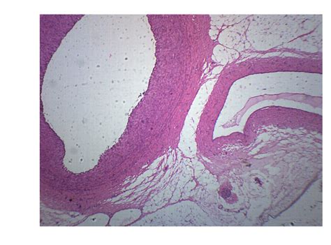 Human Artery Vein And Nerve Cross Section Prepared Microscope Slide