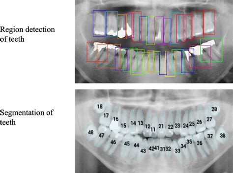 Automatically Region Detection And Segmentation Of Teeth In The