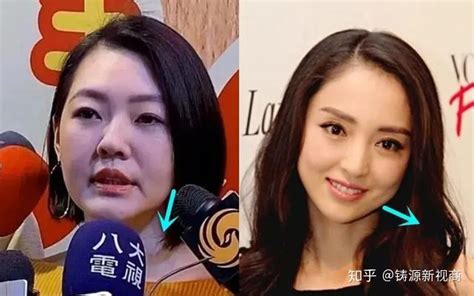 比发福更可怕，刘亦菲也没能幸免，因“发腮”上热搜，如何预防发腮？ 知乎