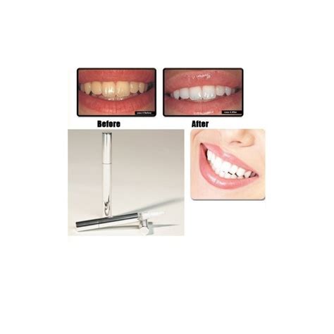 Teeth Whitening Pen безвредна писалка за избелване на зъби