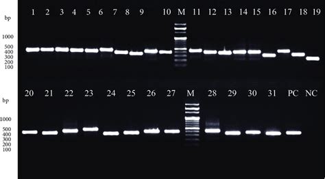 Figure Region X Of The Spa Genes Of S Aureus Isolates 1 31 Isolate