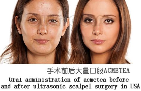 童颜针是什么ACMETEA微美盾吃多久恢复 哔哩哔哩