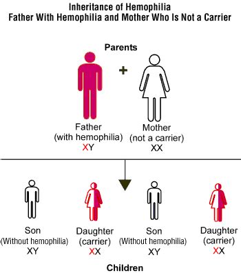 Hemophilia The Missing Factor