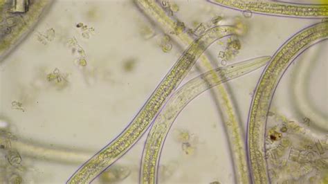 Strong Moving Roundworms Nematodes Under Microscope At 400 Times
