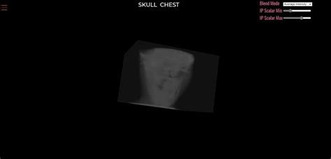 GitHub Abbas DICOM Image Viewer Used In D And D Analysis Volume Rendering Of DICOM