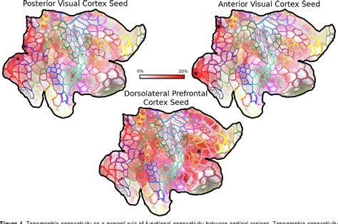 Figure 1 From Topographic Mapping As A Basic Principle Of Functional Organization For Visual And