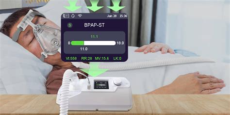 Smart Bipap Machine Ranealth
