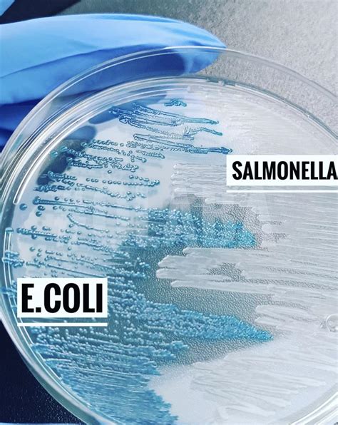 Li Chrom Agar Rmicrobiologyobsession