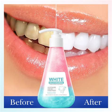 Colorful Whitening Toothpaste Remove Tooth Stains Clean Teeth Oral Care