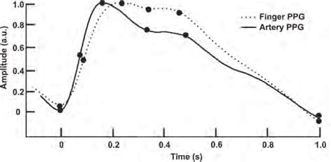 Representative Example Of Typical Curve Demonstrates Shape Differences