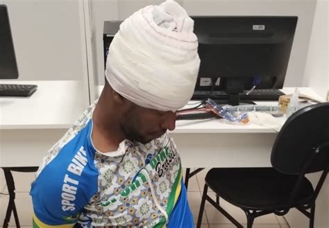 Aluno De Direito Promove Ataque Com Spray De Pimenta Dentro De