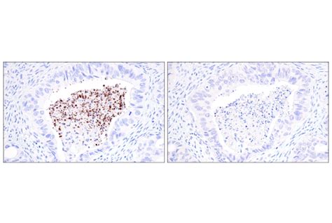 Citrullinated Histone H3 Antibody Arg17 E4o3f Cith3 Cell