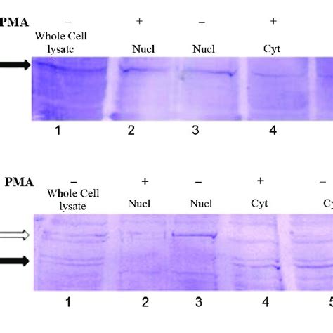 Expression And Localization Of Hdac1 And Hdac4 Proteins In Subcellular
