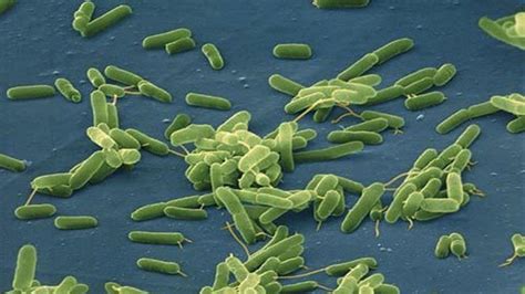 Florida Reportan Cinco Muertos Y Más De 20 Infectados Por Bacteria