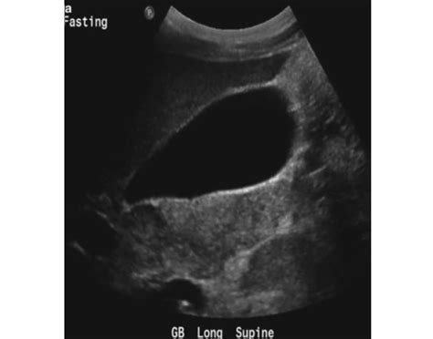 Label The Gallbladder Quiz