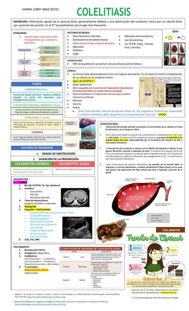 Colelitiasis Hanna Abad Udocz