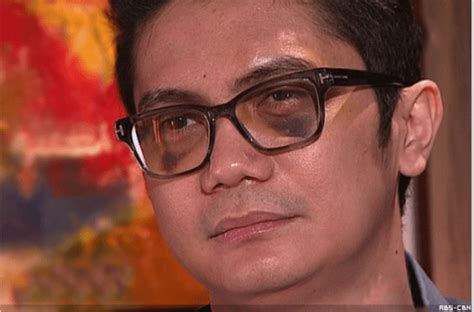 Vhong Navarro Denies The Viral Photo Of Burned Private Part