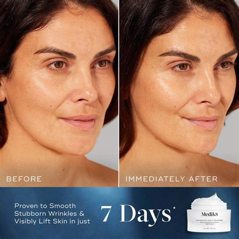 Advanced Night Restore™ Medik8