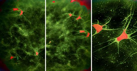 Fluorescence Microscopy Explained Fluorophores To Filters