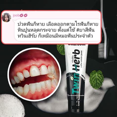 เคล็ดลับดีๆ ปวดตรงไหนอุด ทวิน เฮิร์บtwin Herb Thailand