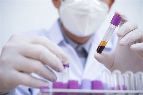 Analysis Of Plasma 17 Hydroxyprogesterone Androstenedione And