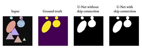 u net：编码器 解码器架构与跳跃连接在图像分割中的应用 csdn博客