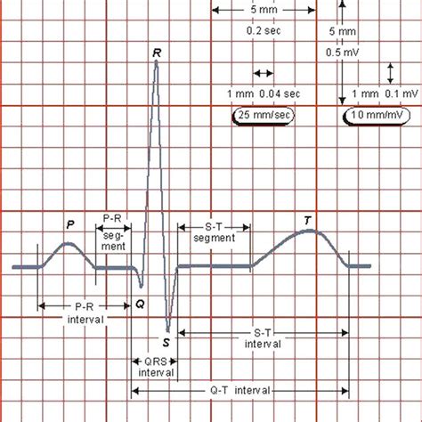 Original Ecg Signal Blue A Reconstructed Ecg Signal Black B Download Scientific