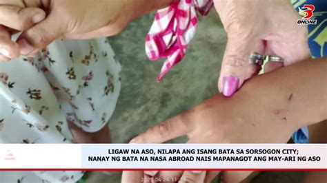 Ligaw Na Aso Nilapa Ang Isang Bata Sa Sorsogon City Nanay Ng Bata Na Nasa Abroad Nais Mapanagot An