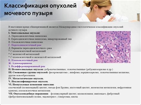 Рак мочевого пузыря презентация онлайн