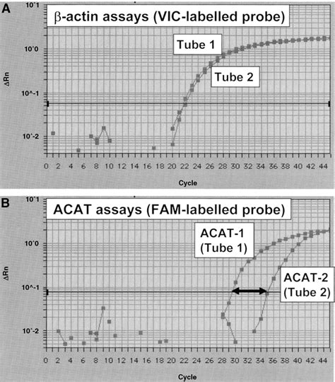 Typical Amplification Plots For Acat 1 Acat 2 And Actin Showing How Download Scientific